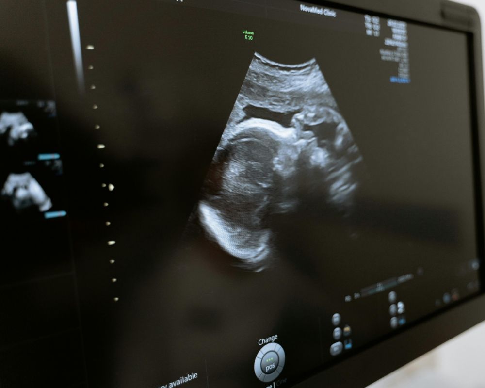 Boy Born Without Brain Surprises Doctors With Incredible Discovery 6 ...