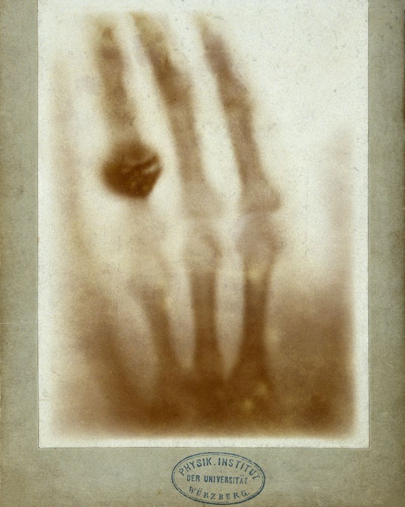 30+ Crazy Images of Medical Treatments Through History - simplyurbans.com