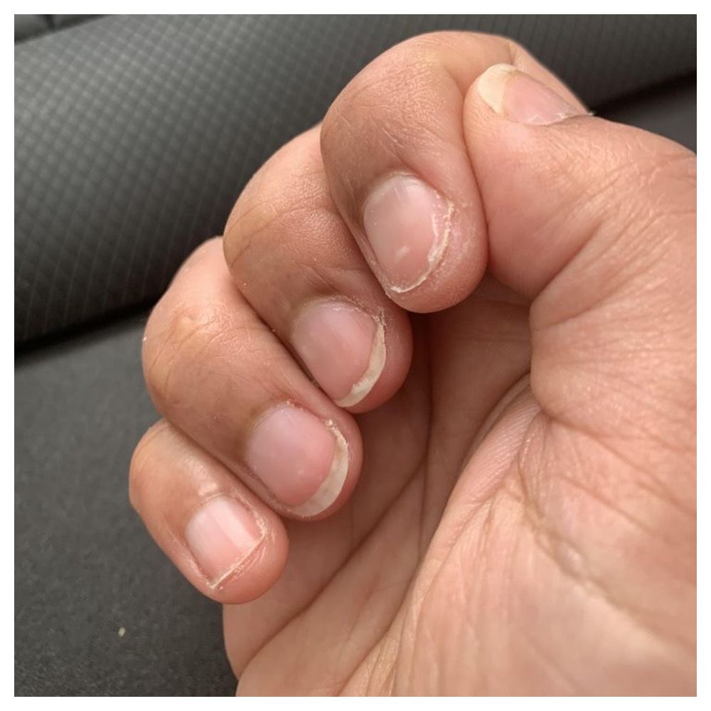 Nail Experts Are Sharing the Biggest Nail Mistakes You're Making ...