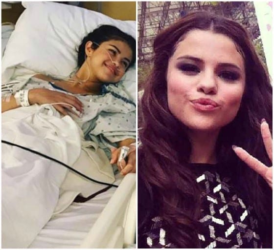 25 famosos que padecen una enfermedad y viven su vida plenamente ...
